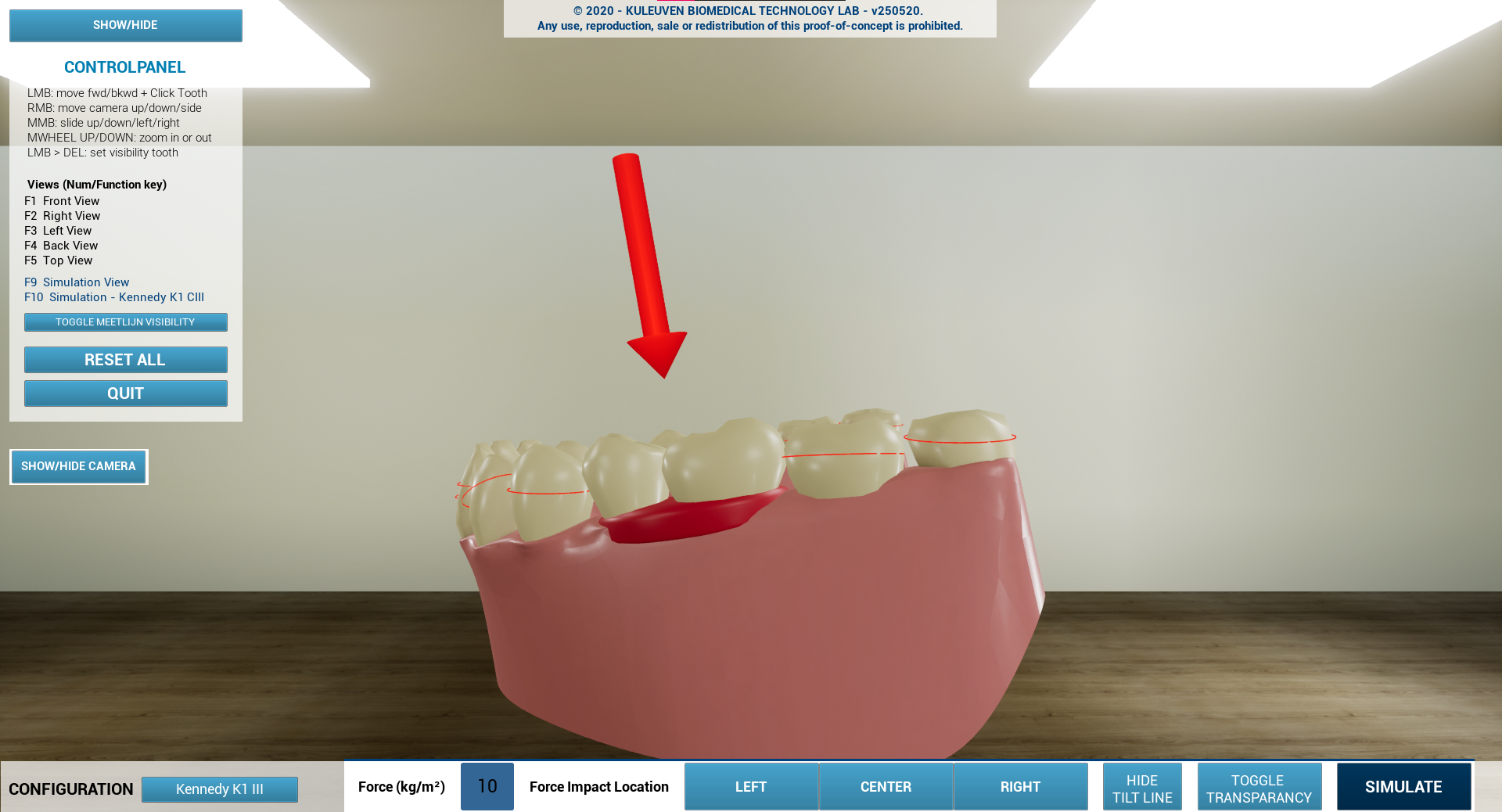 Dental Prosthesis Simulator - Media and Learning Association